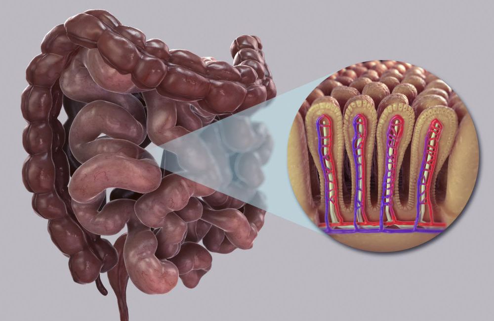 Managing Small Intestine Inflammation (Irritable Bowel Syndrome): What ...