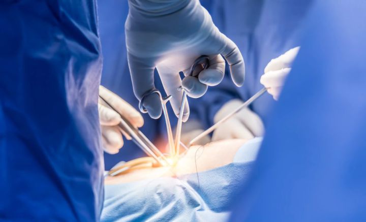 How does splenectomy differ between children and adults? - Expert ...