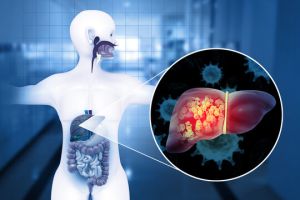 When should the size of a liver cyst become a cause for concern ...